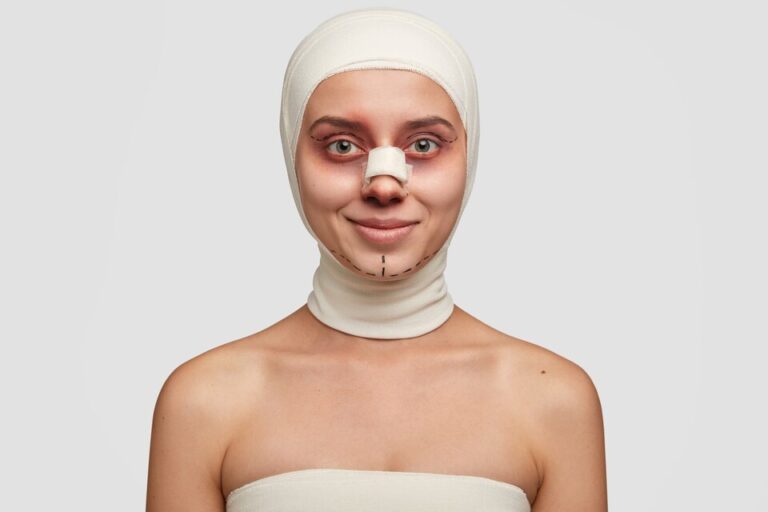 Broken Nose: Symptoms, Treatment, and When to Seek Surgery - Royal ...